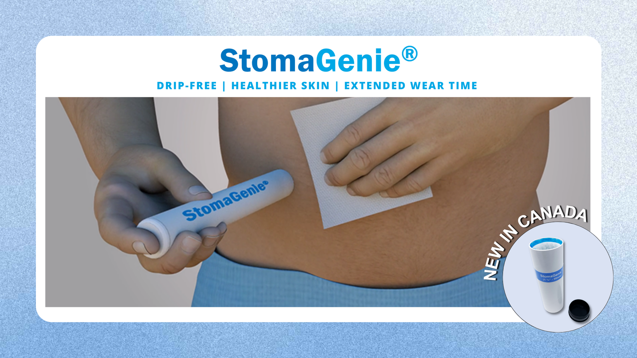Introducing the StomaGenie: A better solution for ostomy changes ...